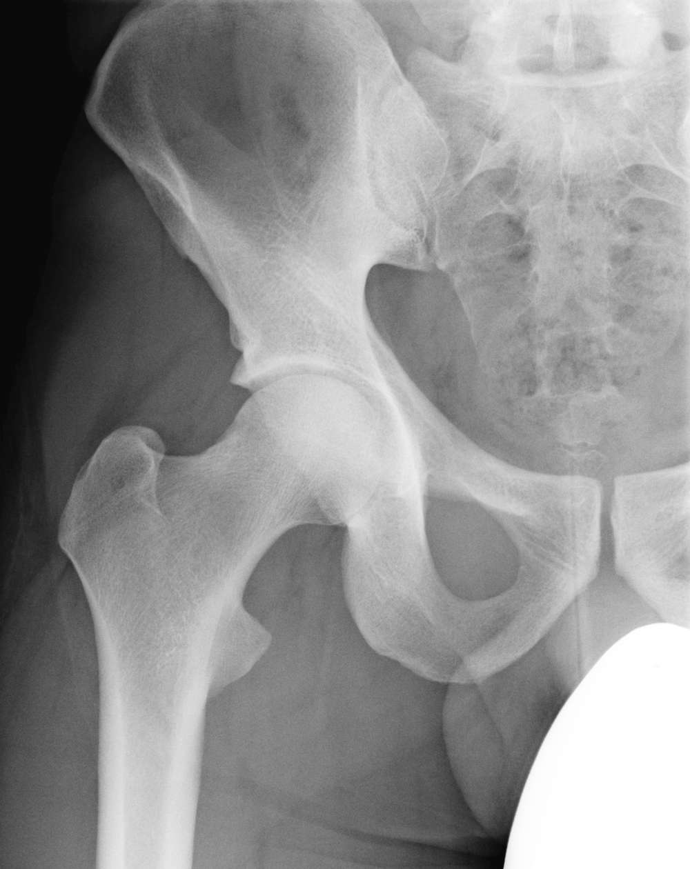 Hüfte • Gemeinschaftspraxis Hauzenberg